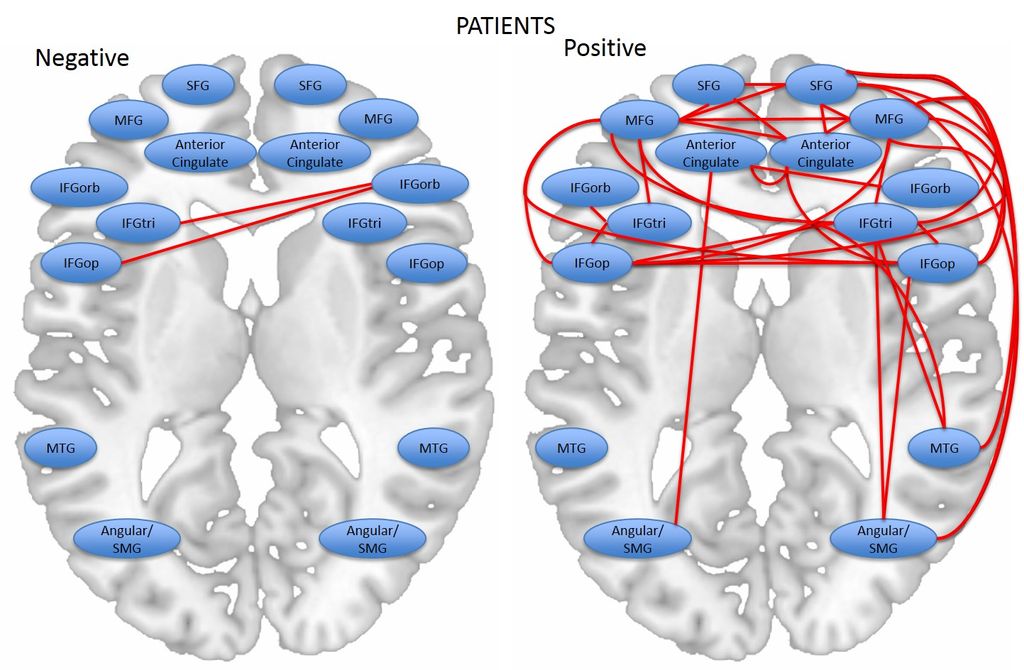 aphasia, lab, boston, research, therapy, treatment, new england, free ...