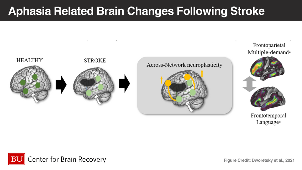 Spotlight Research: Multiple Demand Study | Center for Brain Recovery