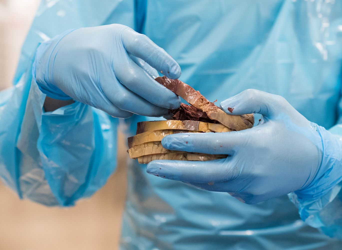 Inside BU's Cadaver Lab | BU Today | Boston University