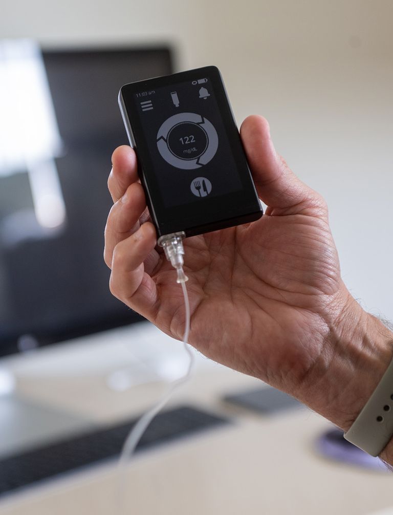 How the iLet Bionic Pancreas Could Revolutionize Type 1 Diabetes ...