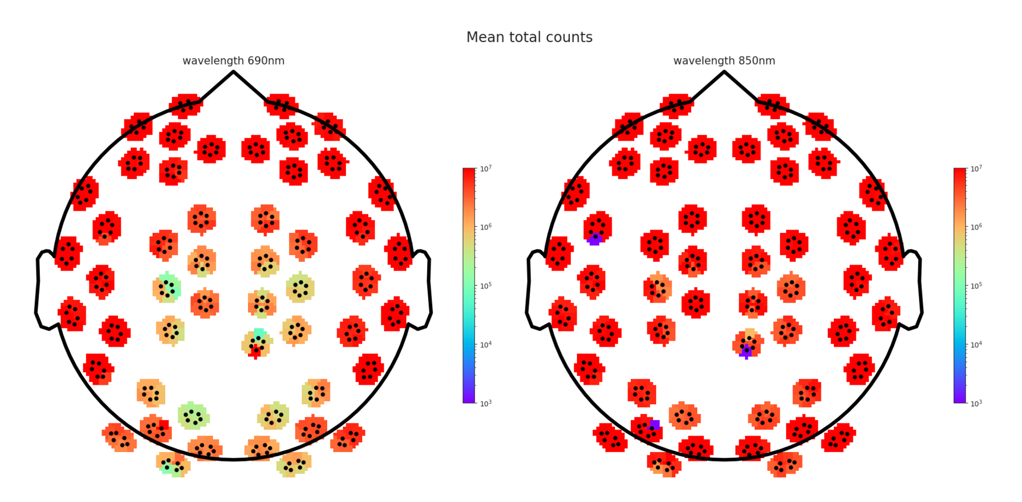 First Experience with the Kernel Flow Device | Neurophotonics Center