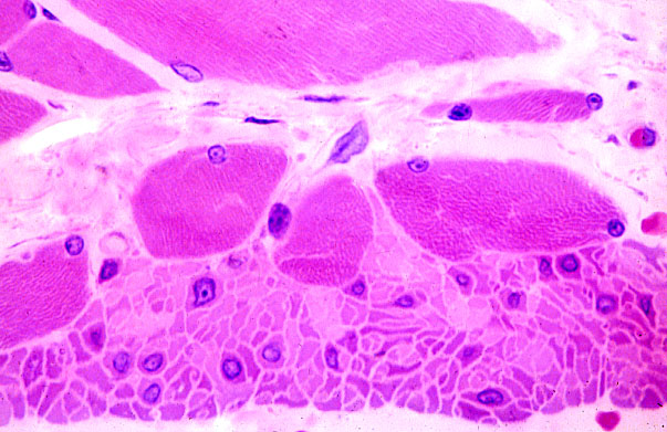 HLS [ Muscle Tissue, skeletal and smooth muscle fibers] HIGH MAG