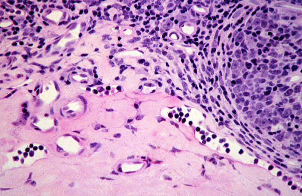 HLS [ Lymphoid Tissues and Organs, lymphatic capilaries with ...