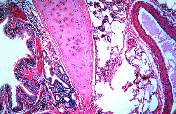 HLS [ Respiratory System, lung (sheep), intrapulmonary bronchus] HIGH MAG