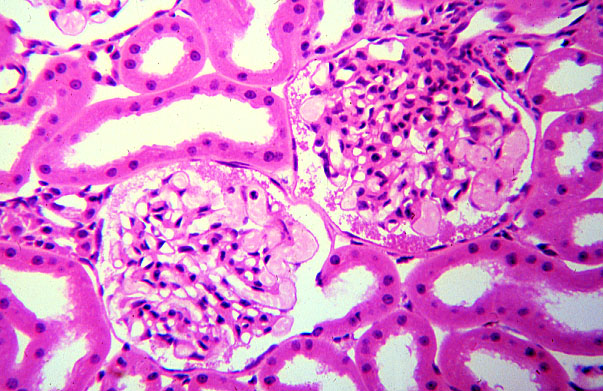 HLS [ Urinary System, kidney, H&E, vascular/urinary poles] HIGH MAG