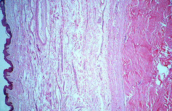 HLS [ Male Reproductive System, penis, skin] HIGH MAG