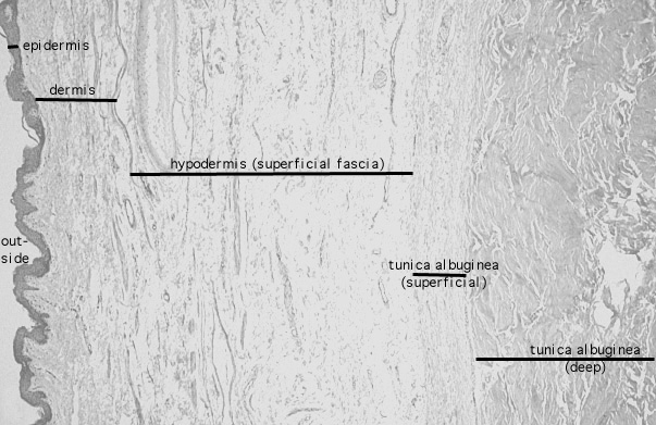 HLS [ Male Reproductive System, penis, skin] HIGH MAG labeled